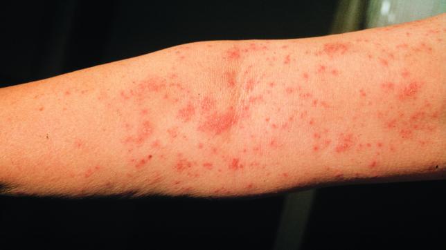 Year-round control of external parasites